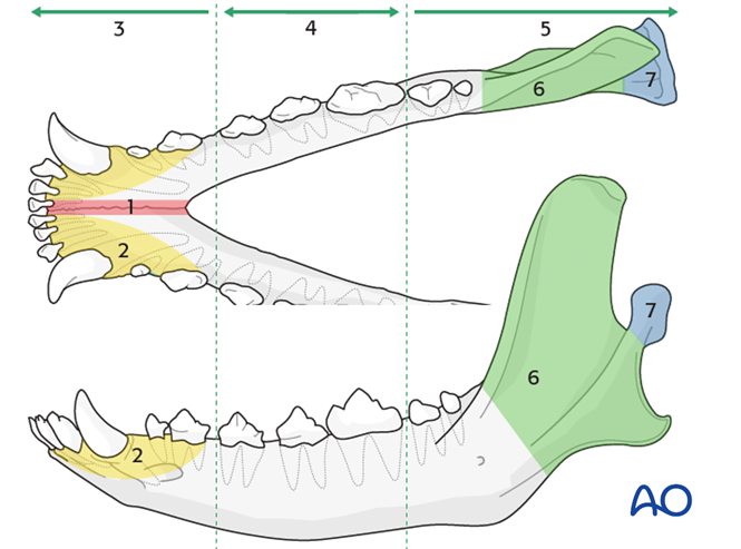 Temporomandibular joint fracture