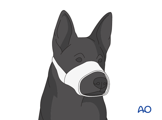 Nonsurgical fracture management for Mandible, Ramus fractures