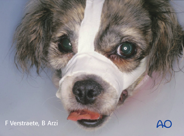 Nonsurgical fracture management for Mandible, Ramus fractures