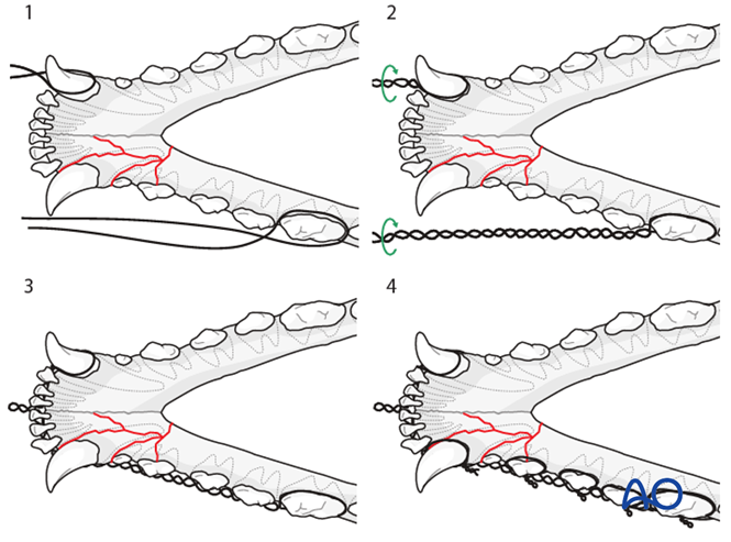 Wire reinforced intraoral splinting for Mandible, Rostral: Unilateral ...