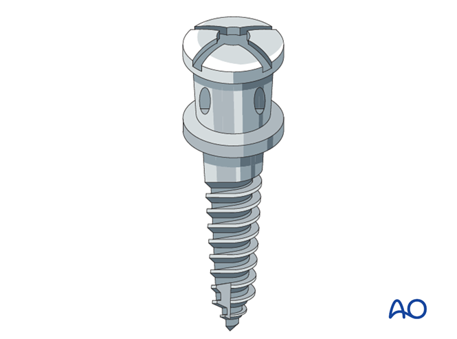 Intermaxillary fixation (IMF) screw and elastic chain for Mandible ...