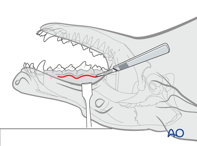 Intraoral approach to the maxilla