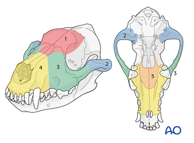 Non- or minimally displaced panfacial fractures