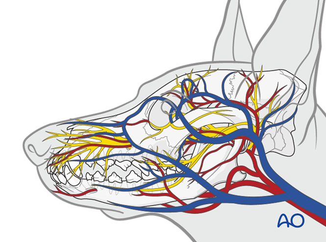 Simple zygomatic arch fractures