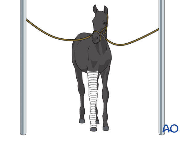 Transphyseal bridge for Radius: Distal physeal fractures
