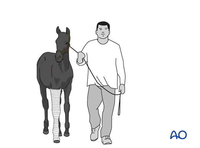 Transphyseal bridge for Radius: Distal physeal fractures