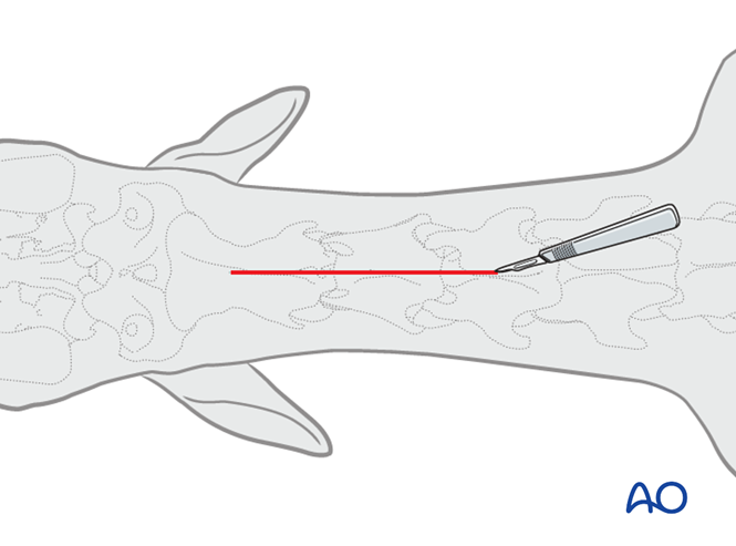 Ventral midline approach to the equine cervical spine