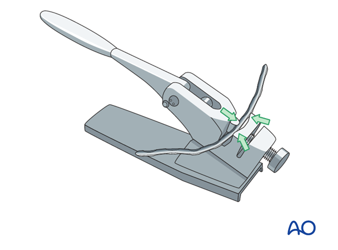 Plate fixation (dorsally) for C2 (Axis) body fractures