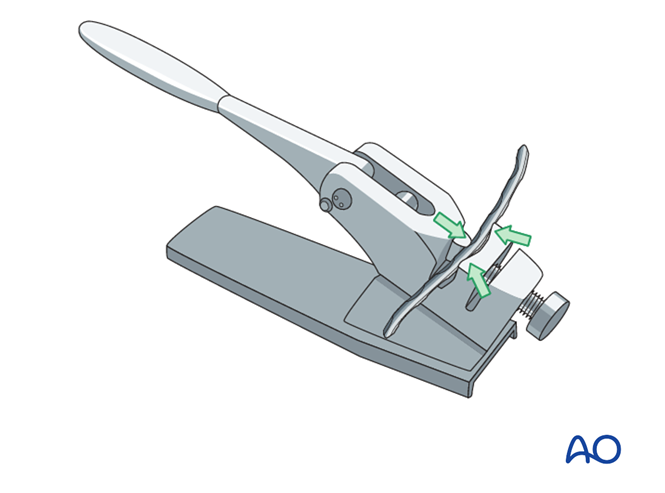 Plate fixation for Sacral fractures