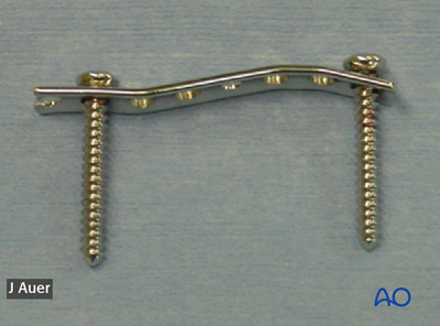 Growth retardation for Angular limb deformities