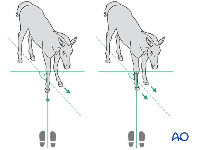 Angular limb deformities