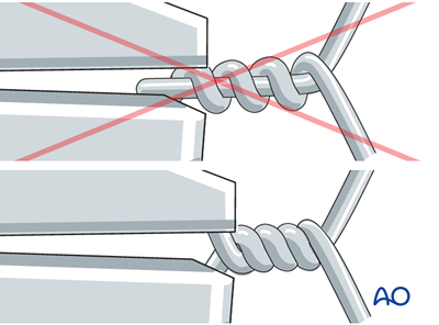 Growth retardation for Angular limb deformities