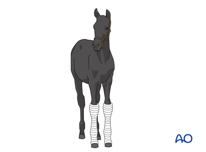 Growth acceleration for Angular limb deformities