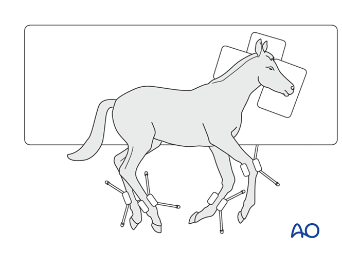 Growth acceleration for Angular limb deformities