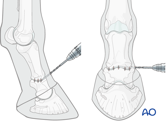 Dorsal approach to the equine proximal interphalangeal (pastern) joint