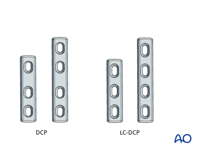 Fixation with a DCP or LC-DCP