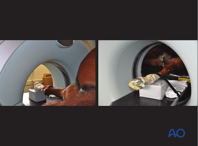 Distal phalanx: Solar margin fractures