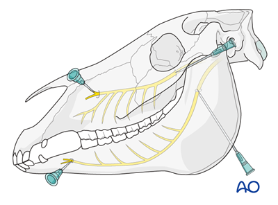 Dorsal recumbency
