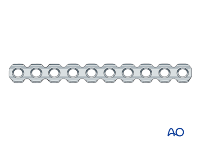 Plate fixation for Suture periostitis
