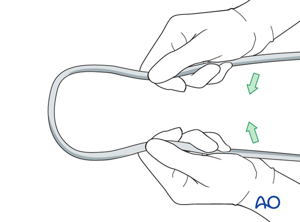 U-shaped splint for Horizontal ramus/interdental space: Bilateral fractures