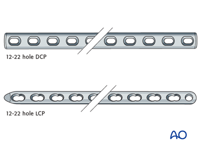 Plate fixation for Fractures of the vertical ramus