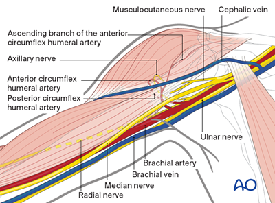 Deltopectoral interval approach to the proximal humerus