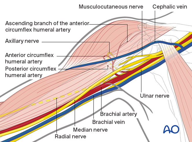 Deltopectoral interval approach to the proximal humerus