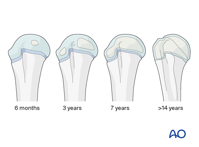 Proximal humeral anatomy