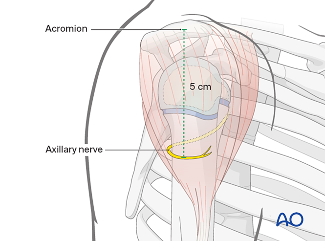 Proximal humeral anatomy