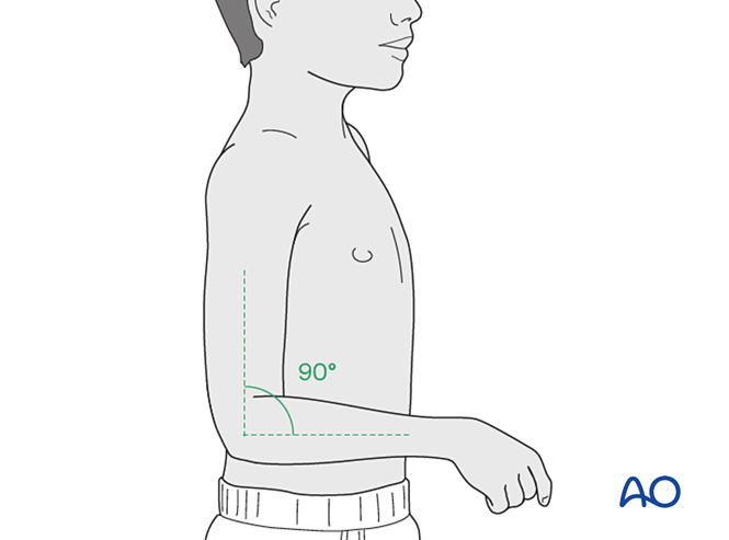 Immobilization with splint, brace, or cast for Simple complete ...