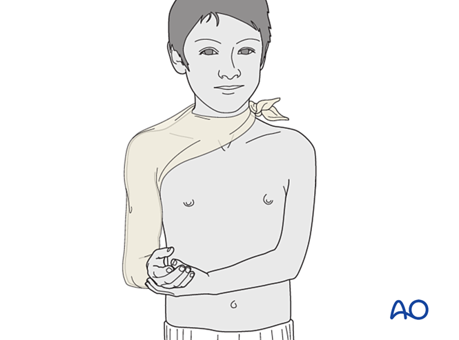 Immobilization with splint, brace, or cast for Simple complete ...