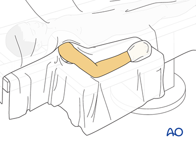 Supine position