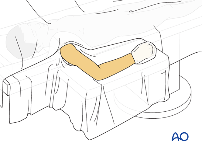 Supine position