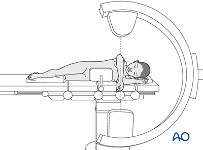 Lateral decubitus position