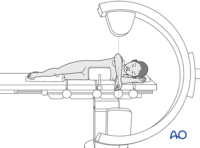 Lateral decubitus position