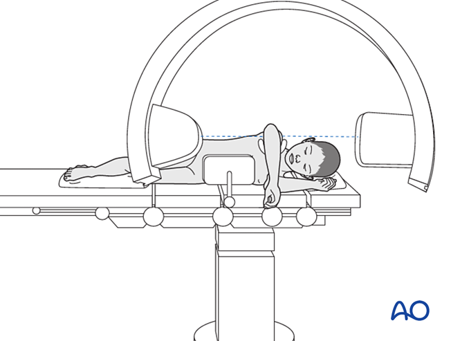 Lateral decubitus position
