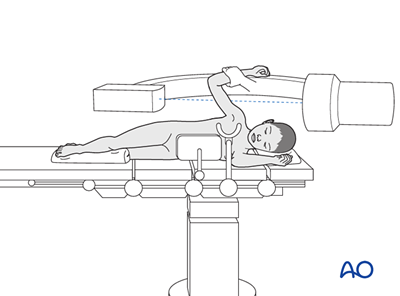 Lateral decubitus position