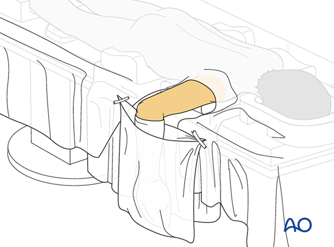 Prone position