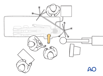 Prone position