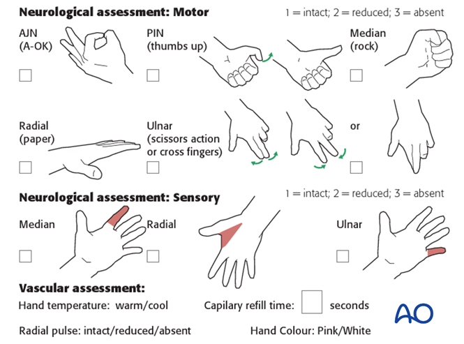 Anterior approach to the pediatric distal humerus