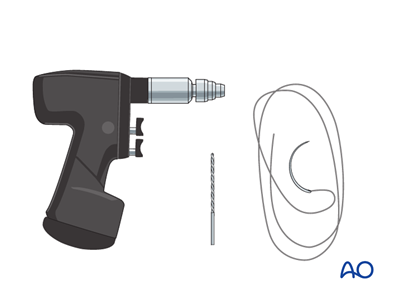 Open reduction; suture or suture and anchor fixation for Avulsion of/by ...