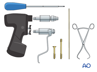 Open reduction; screw fixation for Simple intraarticular flake