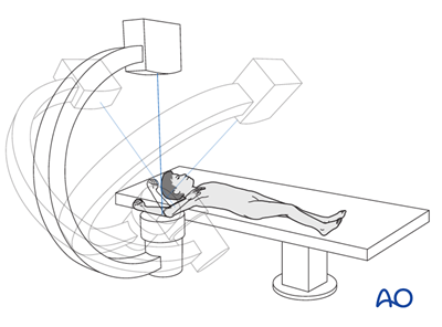Supine position