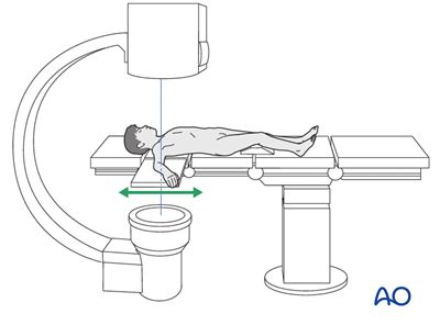 Supine position