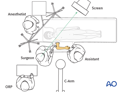 Supine position