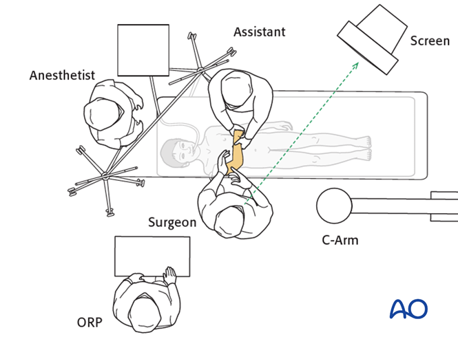 Supine position