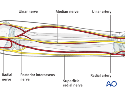 Safe zones for pin placement in the pediatric radius