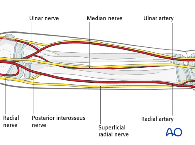 Safe zones for pin placement in the pediatric radius