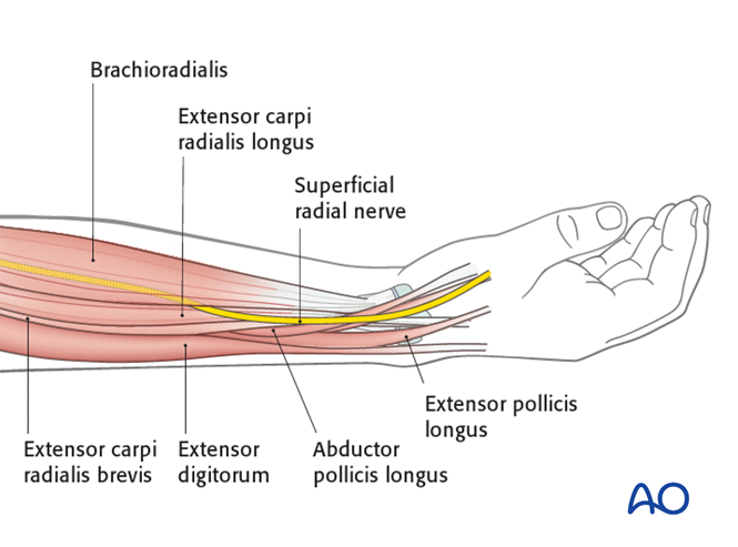 Safe zones for pin placement in the pediatric radius