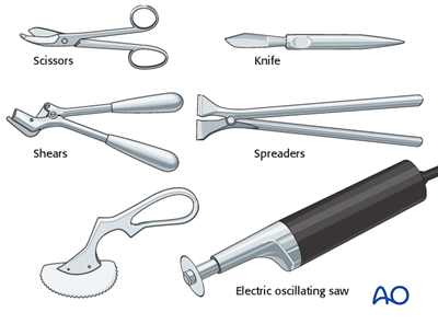 Closed reduction; cast fixation with/without wedging for Both bones ...